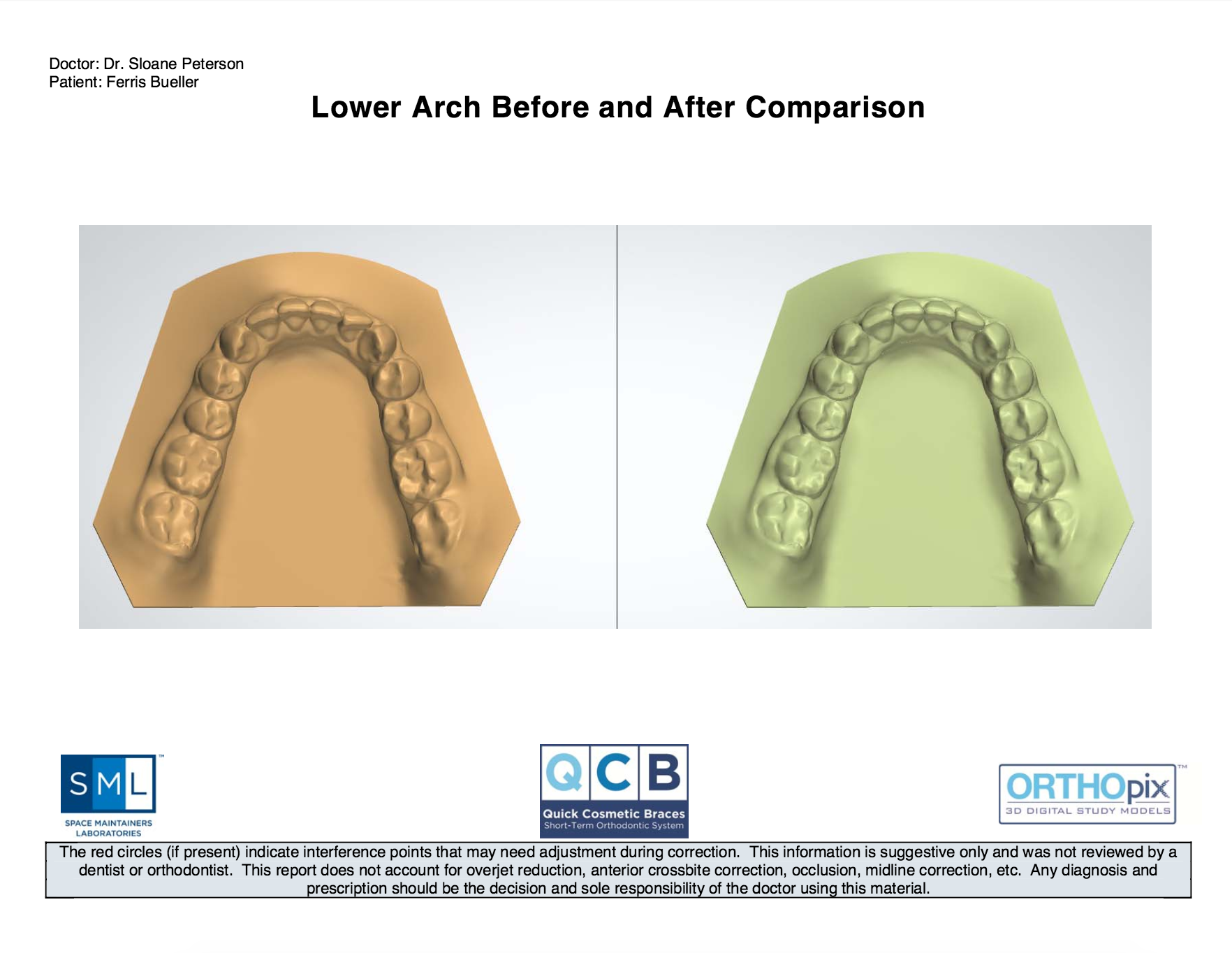 QCB™ IPR Analysis and Digital Models | SML