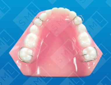 Lower Transitional Partial , Interim Partial, Orthodontic Tools | SML