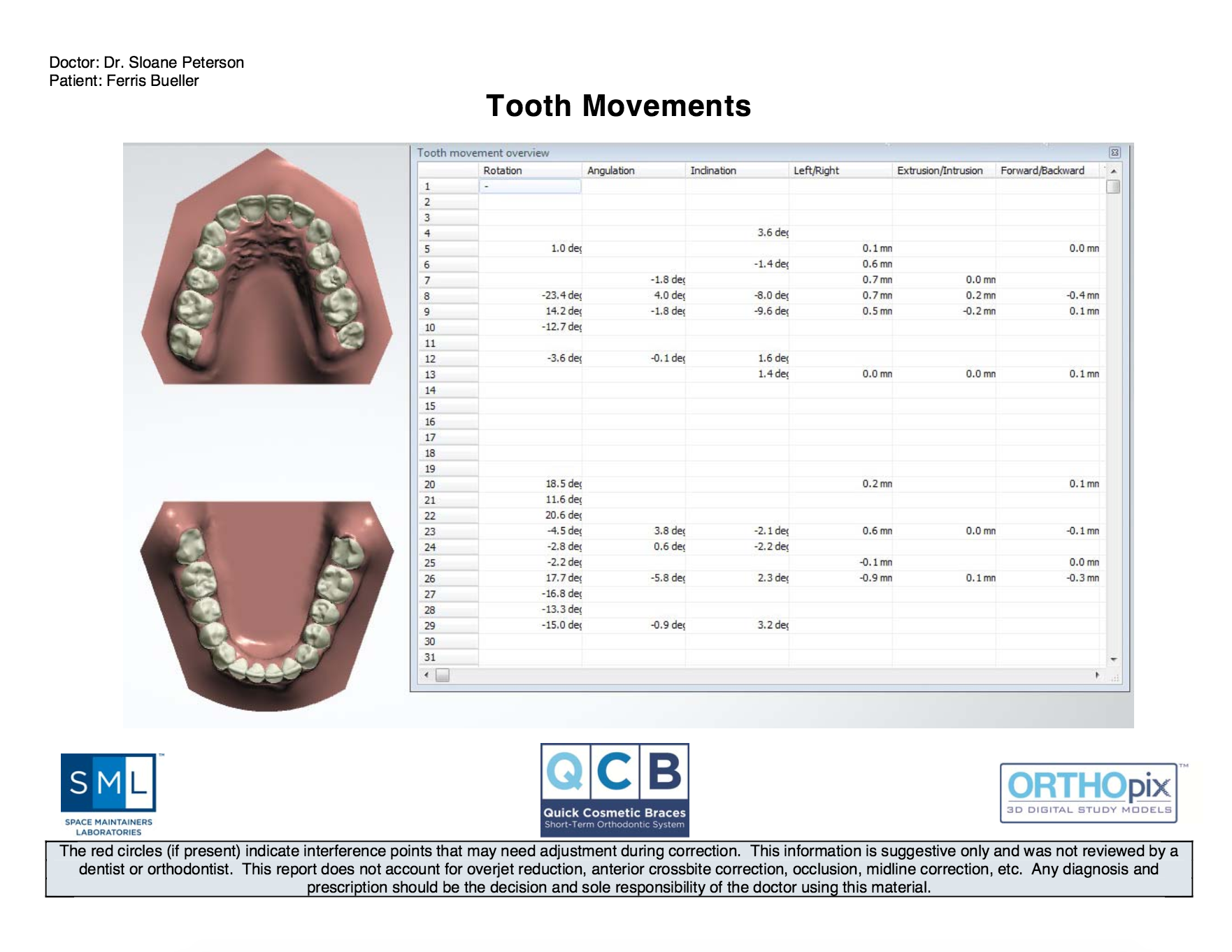 QCB™ IPR Analysis and Digital Models | SML